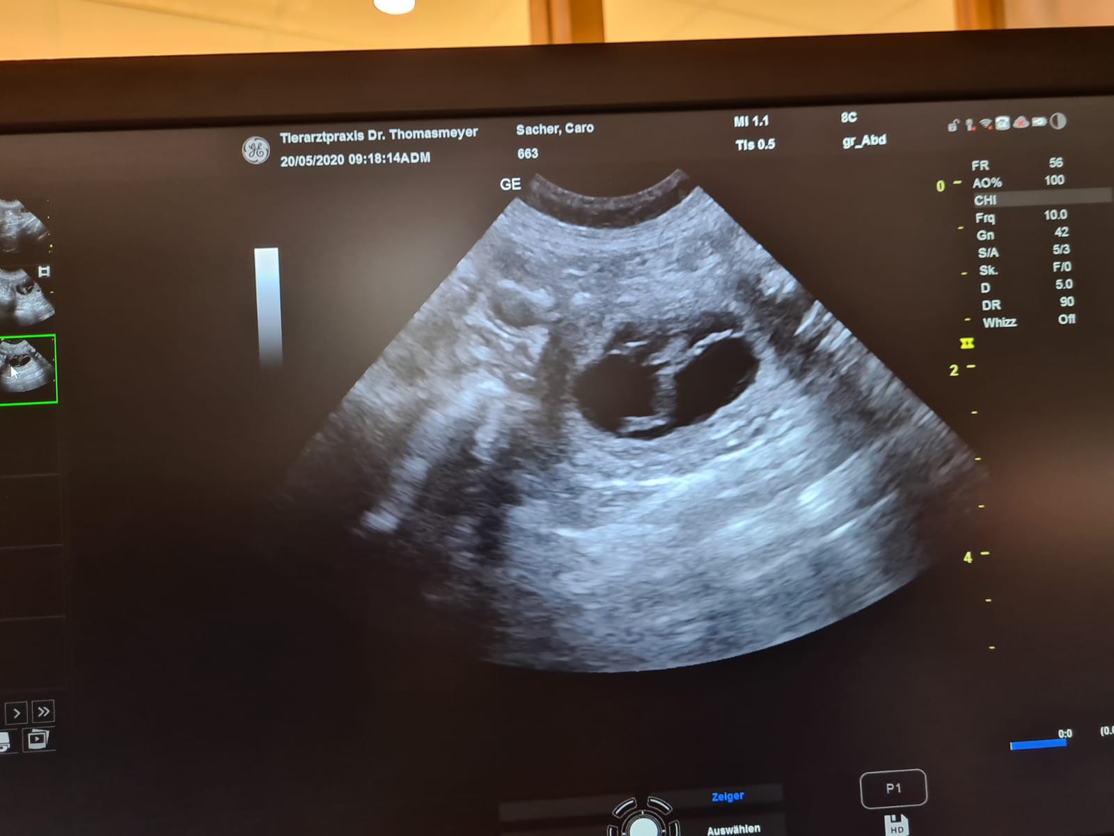 Ultraschall 1
