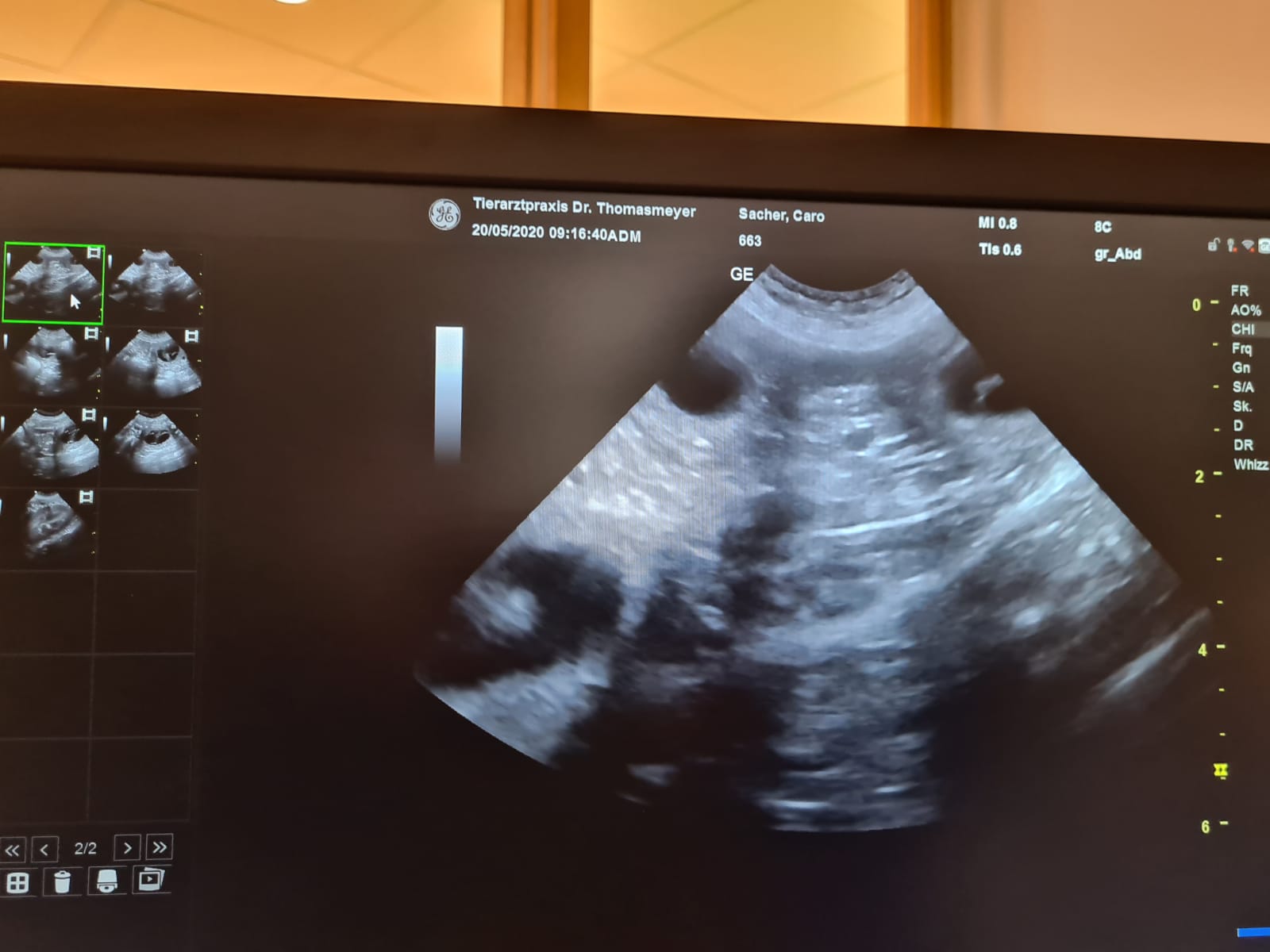 Ultraschall 2